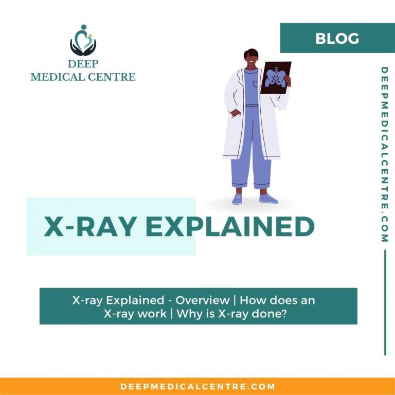 X-ray Articles - Deep Medical Centre