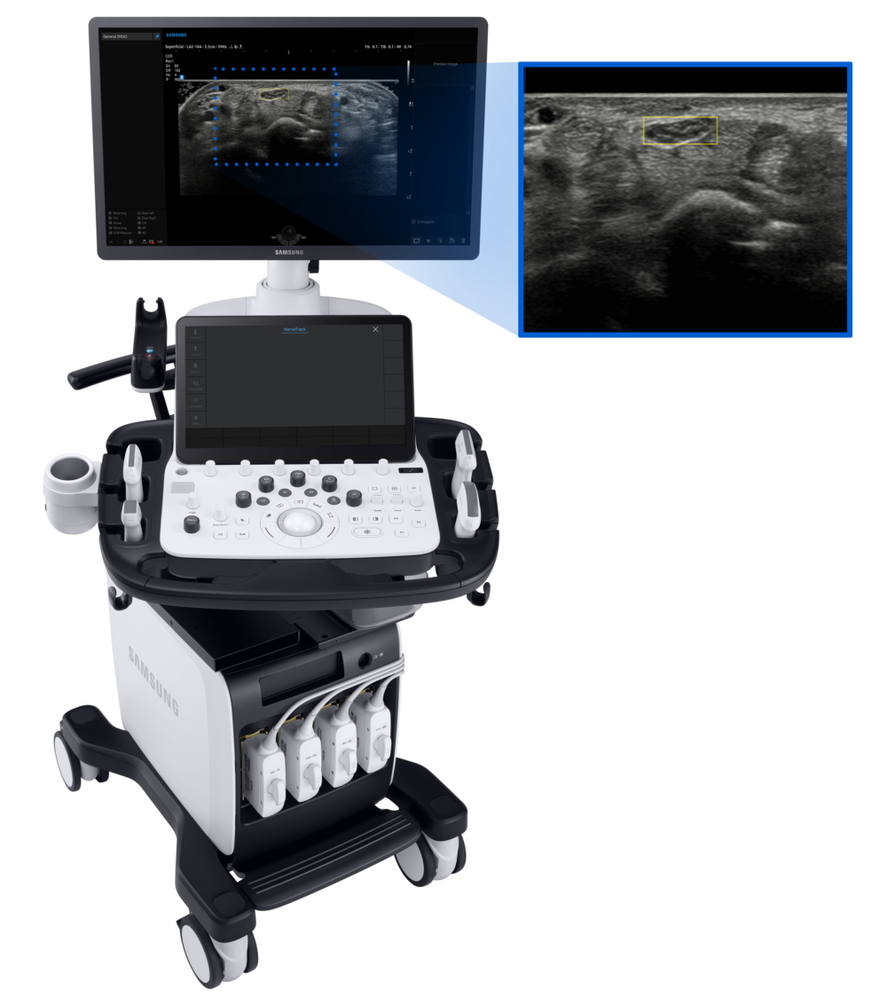 5 Key Differences Between Ultrasound And CT Scans - Deep Medical Centre